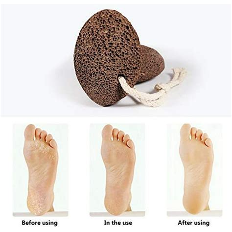Pumice Stone For Feet Scrubber Foot Scrubber Scrub Dead Skin Removal Natural Lava Pumice