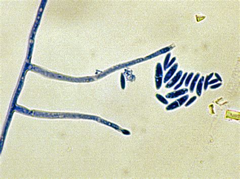 Fusarium Mycology Adelaide University