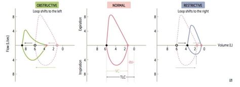 Eli5 This Graph Rstep1