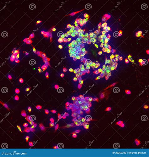 Immunofluorescence Confocal Imaging Of A Single Cancer Cell Stock Image