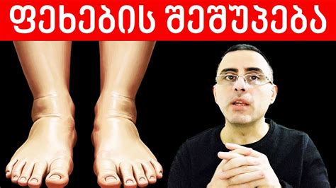 ფეხების შეშუპების 7 მთავარი მიზეზი და მკურნალობა Youtube