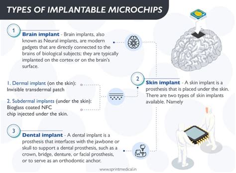 Types Of Implantable Microchips R Coolguides