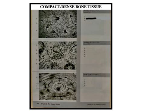 Micrograph Compact Dense Bone Tissue Quiz