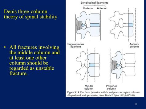 Cervical Spine Injury Antomy And Managementpptx