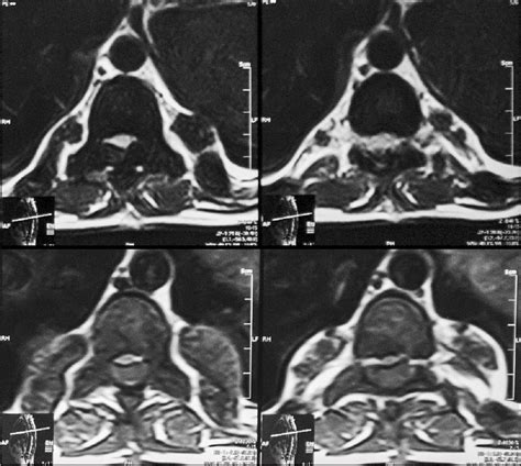 Surgical Neurology International
