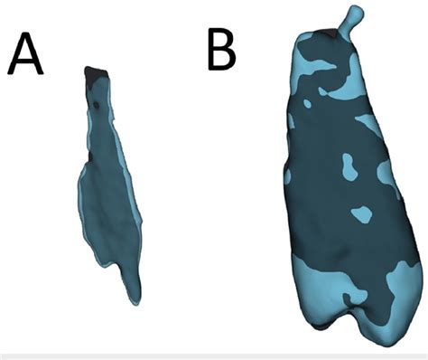 Three Dimensional Rendering Of Segmented A Pulp And Tooth 2 4 B
