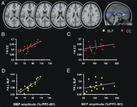 Associations Between FA And TMS Measures A Areas Within The SLF Download Scientific Diagram