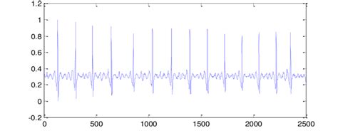 Reconstructed Ecg Signal Download Scientific Diagram