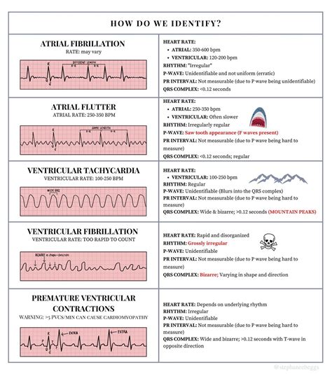 Cardiac Rhythm Cheat Sheet