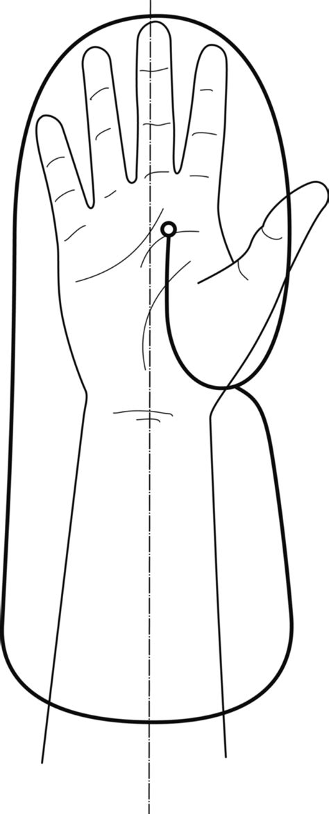 Guide Static Hand Resting Splint