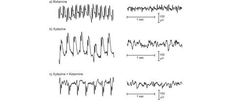 Effect Of Wavelet Filtering On Eegs From Anesthetized Rats Left Download Scientific Diagram