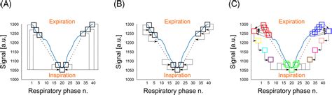 Evaluation Of Image Registration Algorithms For 3d Phase‐resolved Functional Lung Ventilation