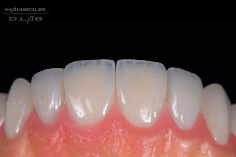 Шигтгэмэл шүдний эмнэлэг Erdenet