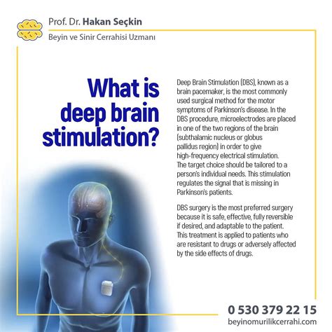 What Is Deep Brain Stimulation Deep Brain Stimulation Dbs Known As A Brain Pacemaker Is The