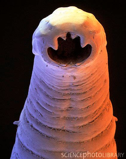 Medical Laboratory Technology Sop Hookworm Filariform Larvae Video