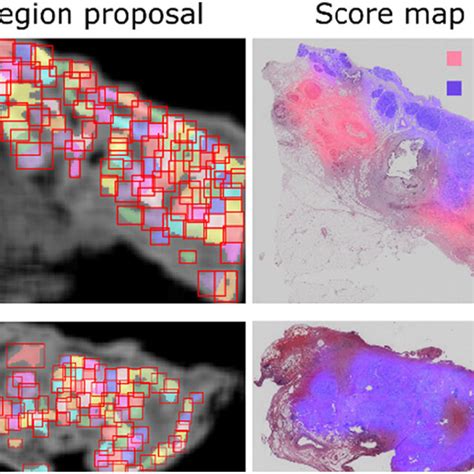 Two Examples Of Region Proposal Generation And Detection Results Top