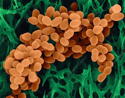 Staphylococcus Aureus Sem Stock Image C032 2550 Science Photo Library