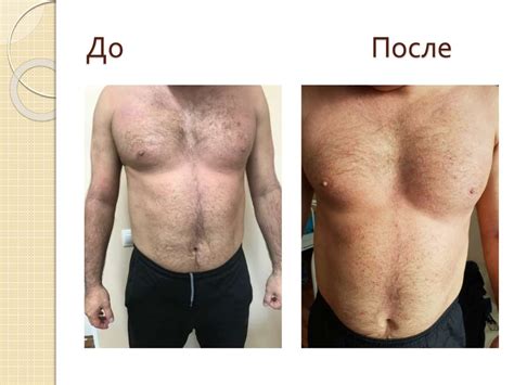 Пациенты с аллергией презентация онлайн