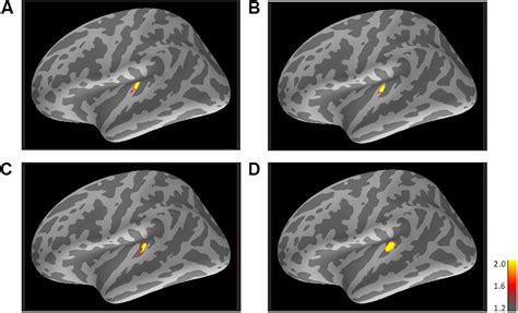 Frontiers Cortical Activity Associated With The Detection Of Temporal
