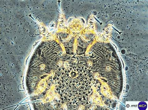 sarcoptes