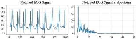 Filtered Ecg Data In The Format Of Time Series And Spectrum Download