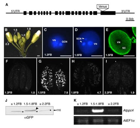 Protein And Gene Expression Of Atbtpc A Schematic View Of The Gene Download Scientific