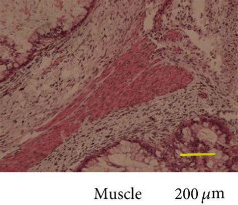 In Vivo Differentiation Of 609 5 IPS Cells XX And 386S 11 XXX IPS Download Scientific