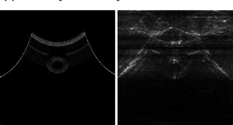 Figure 1 From Simulated Sonar Image Generation Method Based On Improved