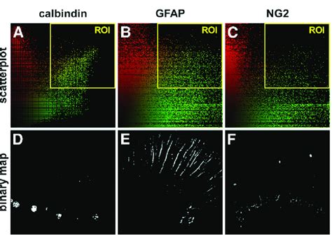 Colocalization Analysis Of Three Double Immunofluorescence Labeling