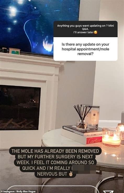 Molly Mae Hague Unveils The Results Of Her Dissolved Filler After