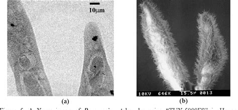 Figure 1 From High Resolution Projection X Ray Microscope Equipped With