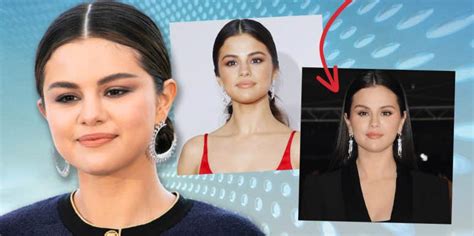 Selena Gomezs Facial Transformation Due To Her Illness Proves Why We