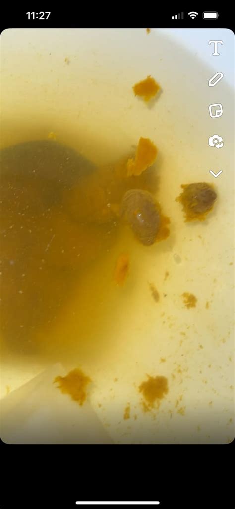 Yellowish Brown Diarrhea My Diarrhea Is Yellow