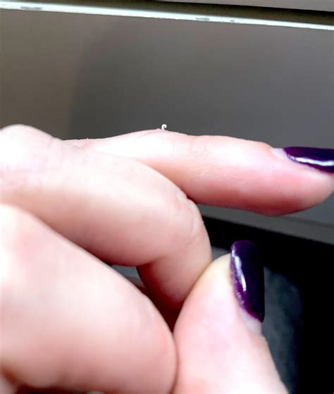 My Reoccurring Knuckle Pimple Rpopping