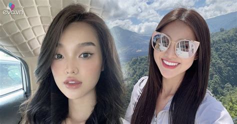 Búp Bê Sống Việt Nam Từng Không Dám Cười Nhờ Dán Lớp Sứ Giá Gần Chục