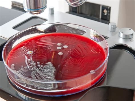 Novel Host Factors Against Staphylococcus Aureus Infection Discovered