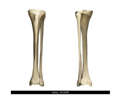 Tibia And Fibula With Bone Markings Quiz