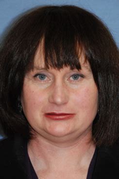 Transgender Surgery Before And After Photos Seattle Bellevue