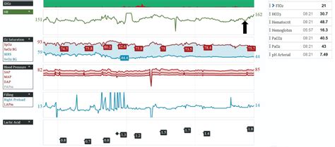 Methods To Enhance Causal Inference For Assessing Impact Of Clinical Informatics Platform