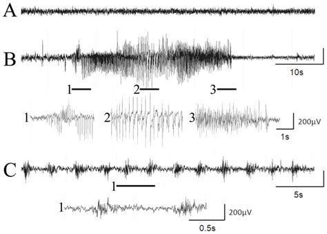A Baseline Eeg Activity B A Typical Seizure Event In An Epileptic Download Scientific