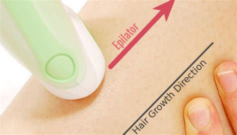 5 Top Epilator Tips These Tips Really Work