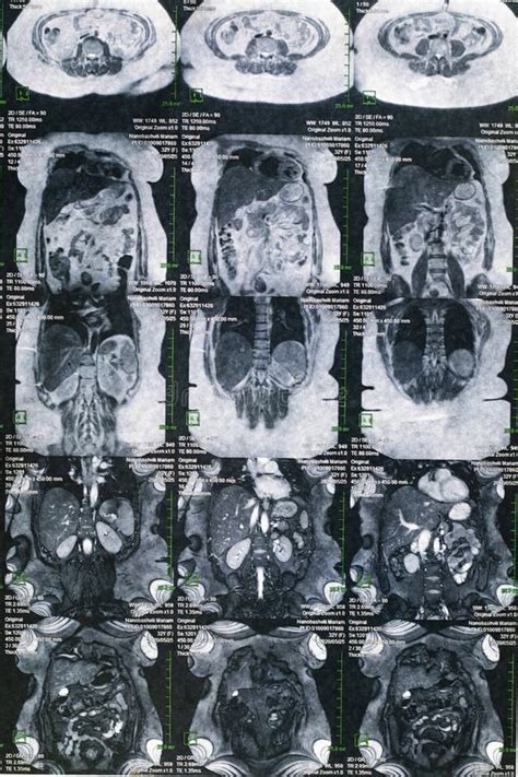 Magnetic Computer Tomography Stock Photo Image Of Machine Xray 319105206