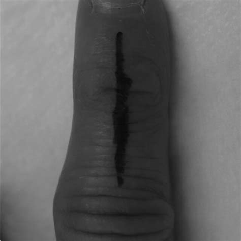 A Extension Block Pin Shown Deviating From The Center Of The Head Of Download Scientific