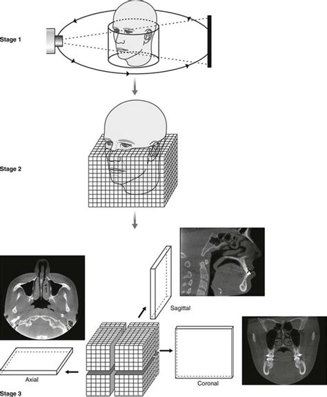 16 Cone Beam Computed Tomography Cbct Pocket Dentistry