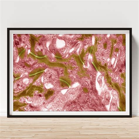 Skin Cell Desmosomes Tem Poster By Science Photo Library Science