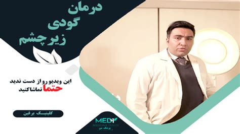 درمان گودی زیر چشم