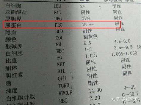 体检报告解读4尿常规 知乎