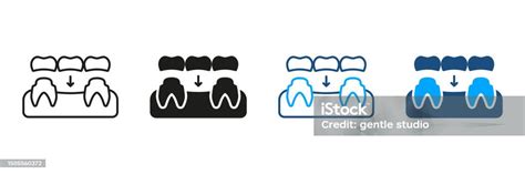 치과 다리 실루엣과 라인 아이콘 세트 도자기 틀니 치아 재생 픽토그램 부분 치아 임플란트 복원 치과 치료 기호 컬렉션 격리된 벡터 그림 건강 진단에 대한 스톡 벡터 아트 및