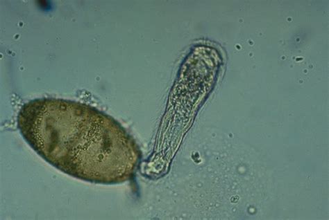 Fasciola Hepatica Metacercariae