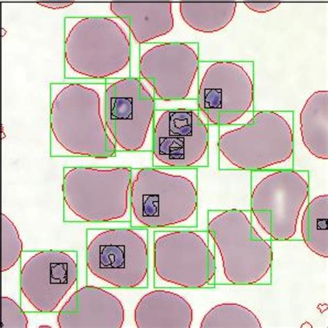 Image Processing Comparing Pixel Density And Number Of Pixel Values Computer Science Stack